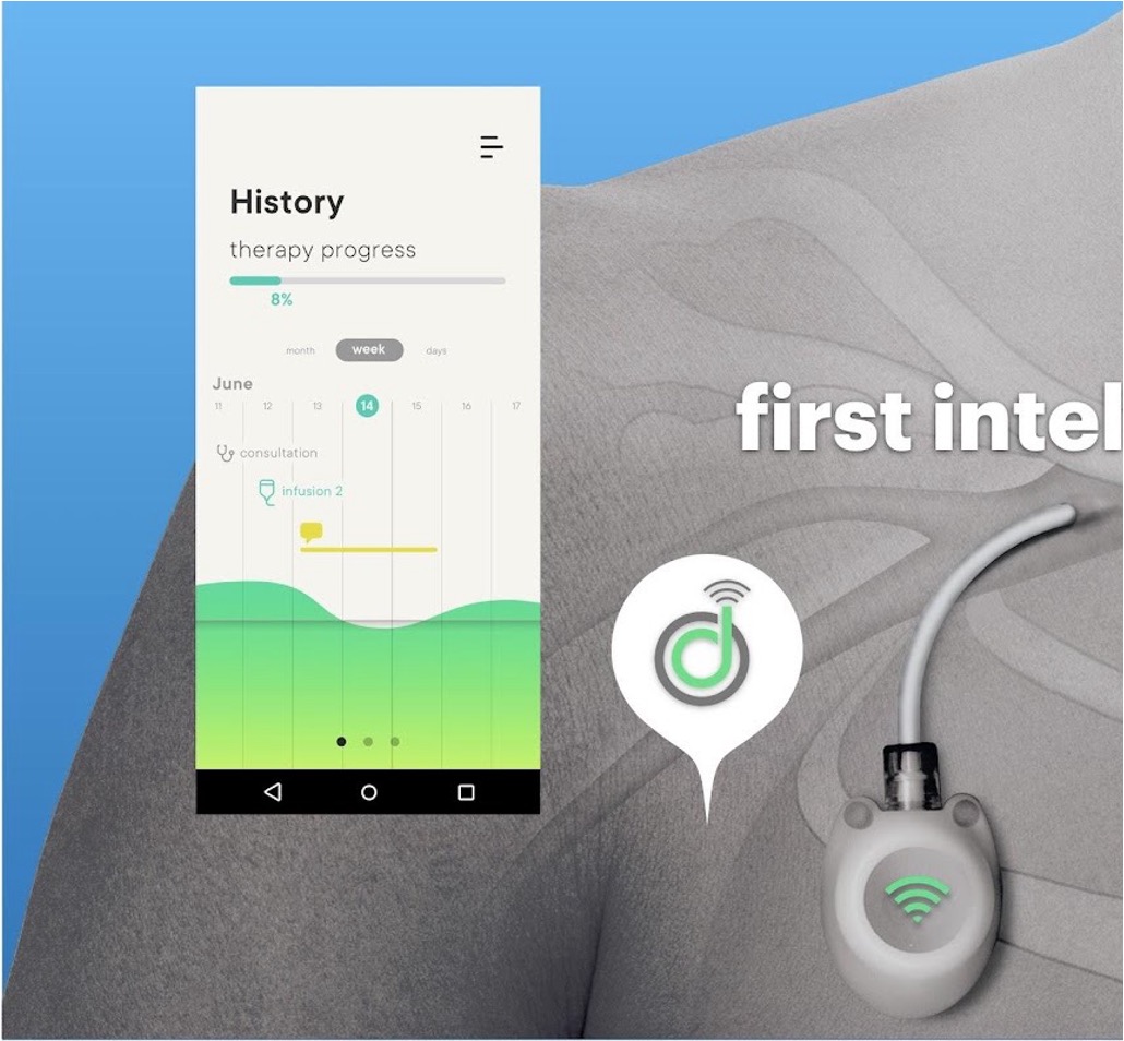 Implantable Oncology Sensor Platform | iO Lifescience
